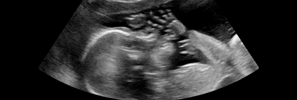 Nathan Cohen – Data Scientist